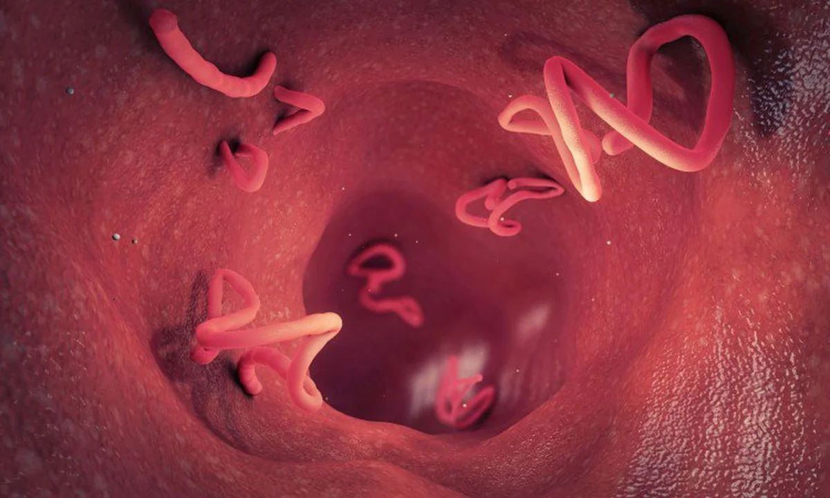 Glista ludzka – objawy, przyczyny, leczenie - Wapteka.pl - Wapteka.pl