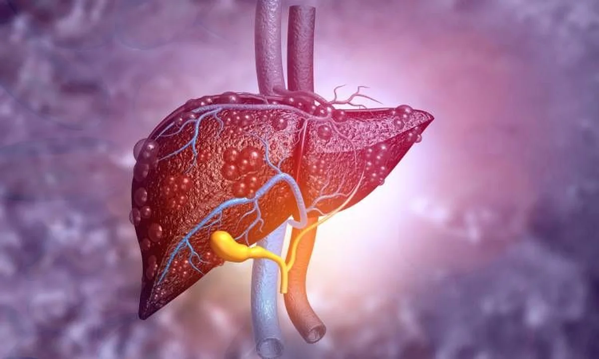 Cholestaza - czym jest i jak ją rozpoznać? | Melisa.pl